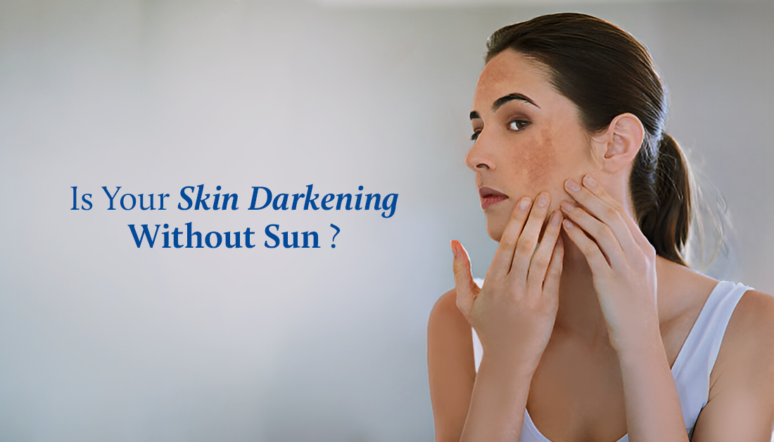 Decoding why is my skin aging and getting darker without sun? – Blue Nectar
