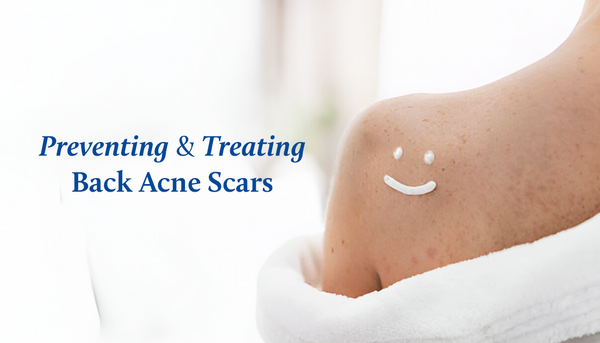 Back Acne Scars: A Complete Guide to Treating Them – Blue Nectar