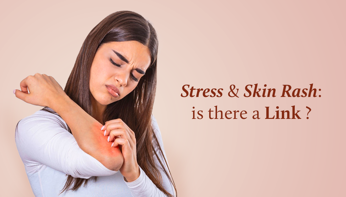Understanding the Effects of Stress on Skin – Blue Nectar