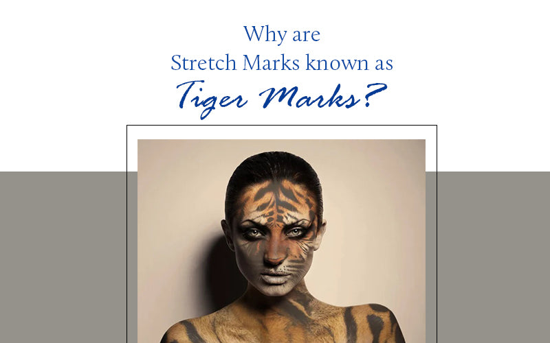 Guide to Stretch Marks and Creams – Blue Nectar