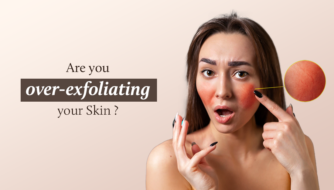 Is your skin over-exfoliated too? Here’s how to deal with it – Blue Nectar